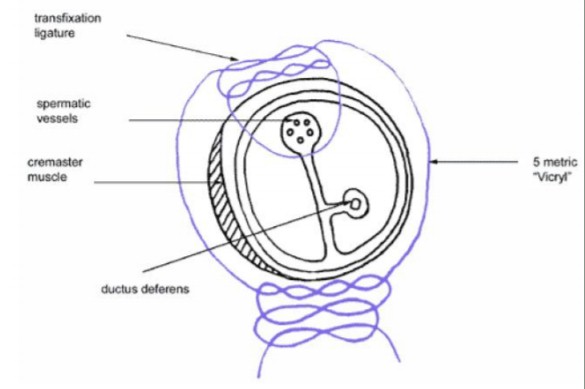 Closed Castration Method